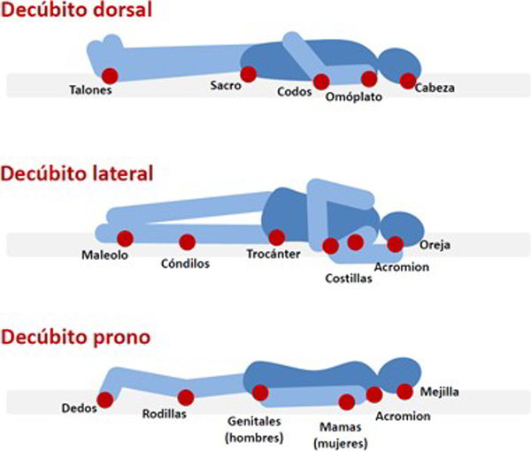 Prevención de úlceras por presión - Ocronos - Editorial Científico-Técnica